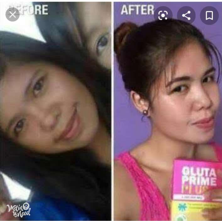 Glutaprime whitening supplement | Ifeoluwa - Wetinuneed